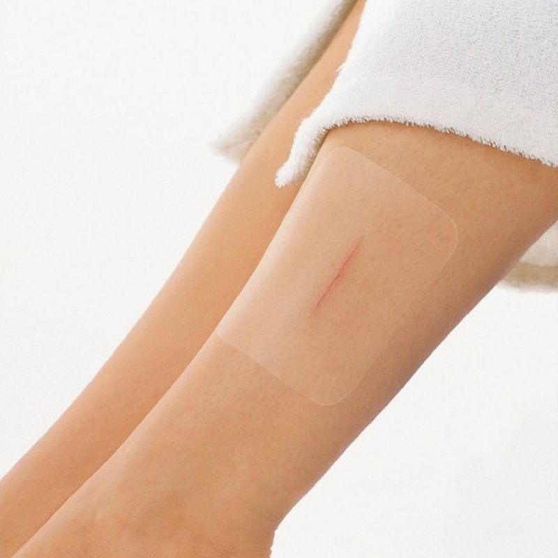 BSN Medical - LEUKOMED T 15 x 25cm - Bte/5 - Pansement Film Adhésif ...